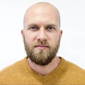 Can a Fully Bald Person Get a Hair Transplant in Islamabad?